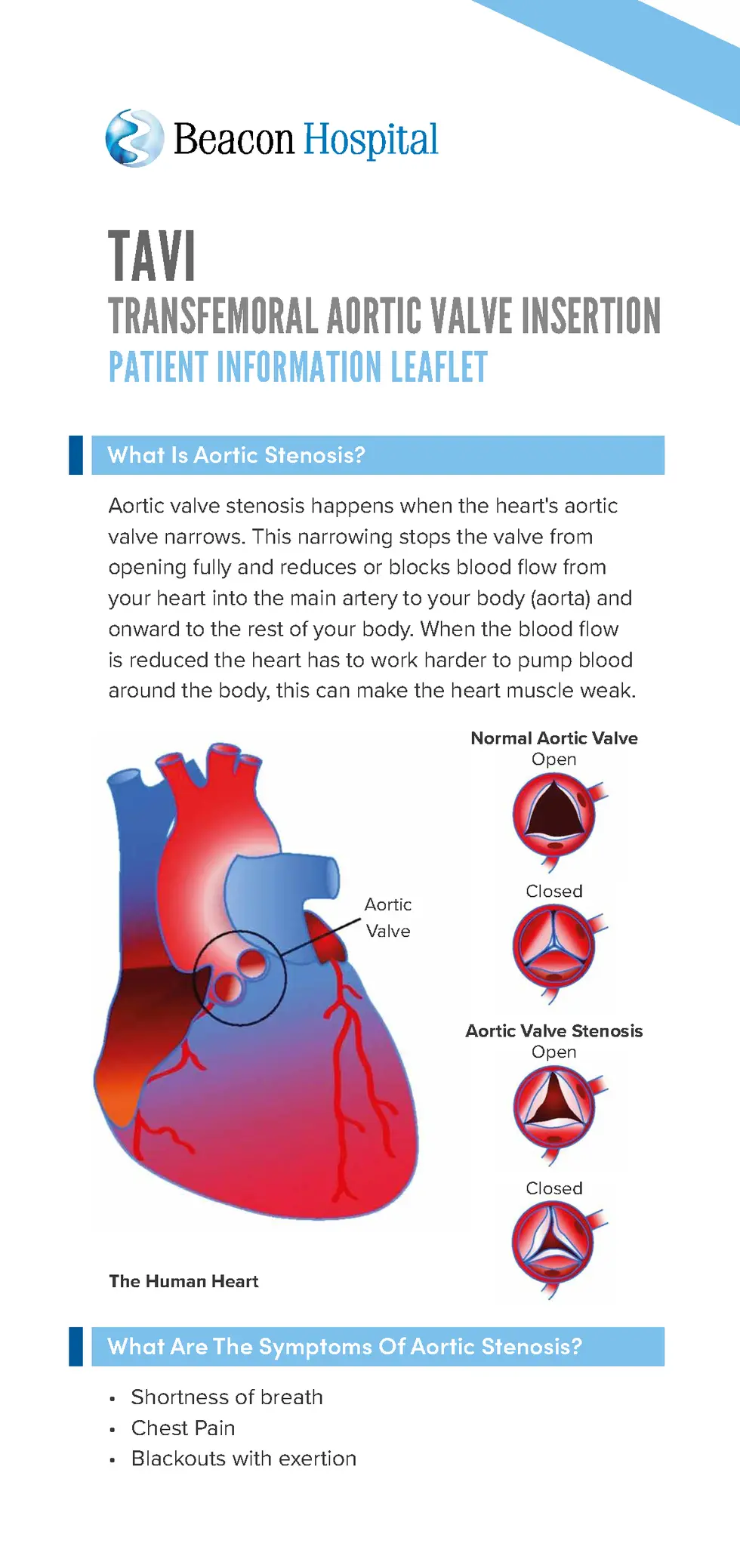 TAVI - Transfemoral Aortic Valve Insertion